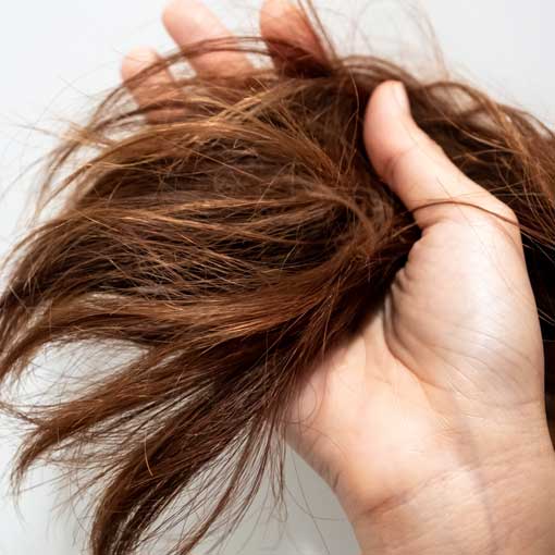 Dry Hair: Symptoms, Causes, & Best Remedies by Experts - Kama Ayurveda